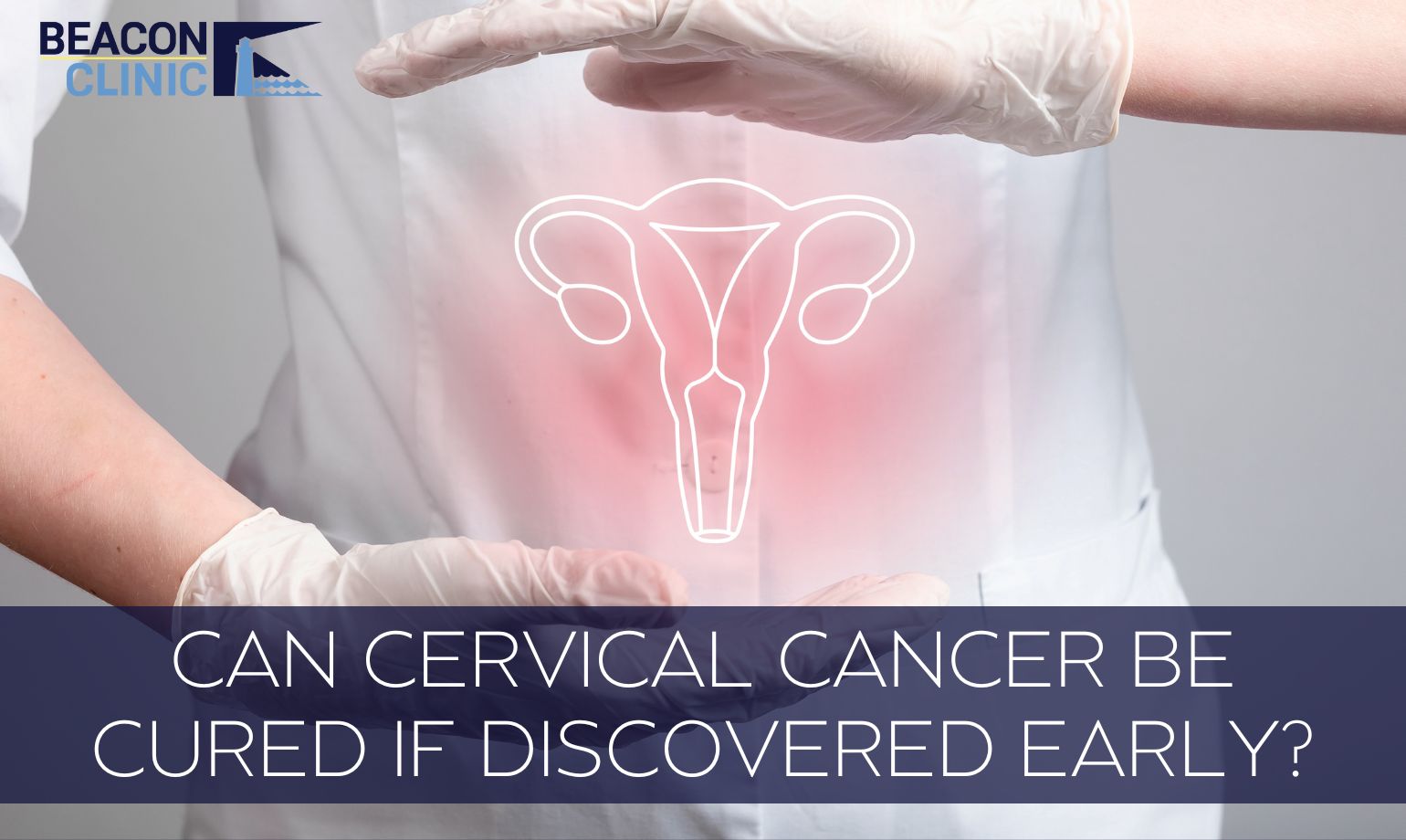 Can Cervical Cancer Be Cured if Discovered Early? - Beacon Clinic